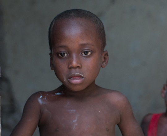 Give Ivanson the Gift of Food and Clean Water