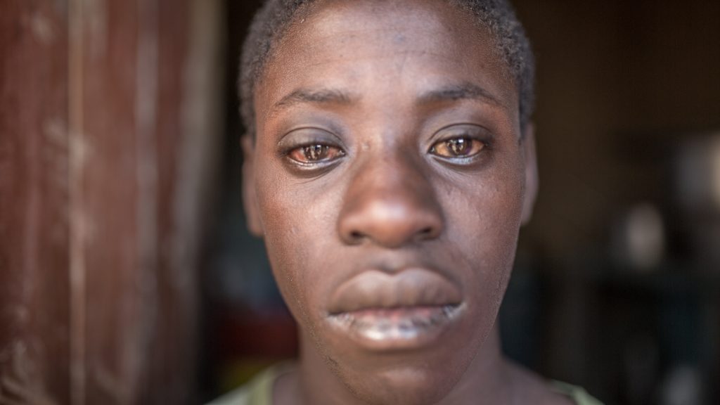 Our Partners on the Ground: The Love of Community Health Workers | CMMB ...